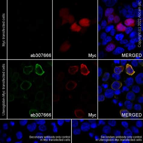 Anti Uteroglobin Antibody Epr27144 86 20 Ul Size Ab307666 Abcam