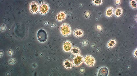 Is That An Oocystis Bloom Researchgate