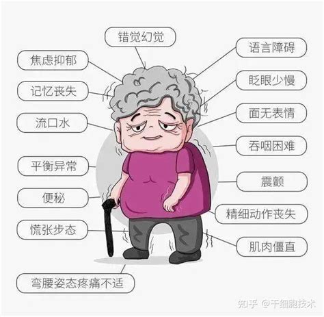 医学突破：干细胞有效攻克帕金森疾病 知乎