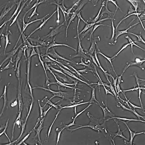 Human Bone Marrow Derived Mesenchymal Stem Cells Kosheeka