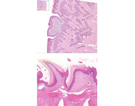 Papilas Da Língua Quiz