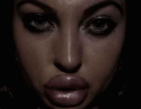 Pretty Girl With Ugly Silicone Lips 25 Pics