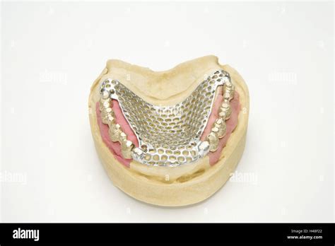 Dentier Mâchoire Supérieure Plaque De Métal Modèle De Gypse
