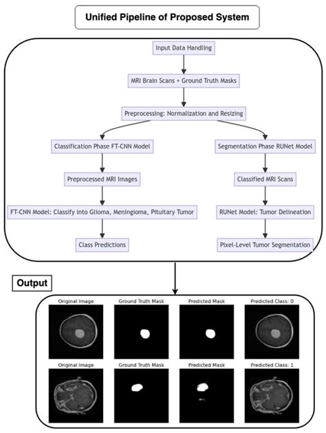 A Unified Pipeline For Simultaneous Brain Tumor Classification And