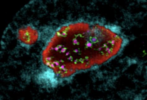 News Lms London Institute Of Medical Sciences