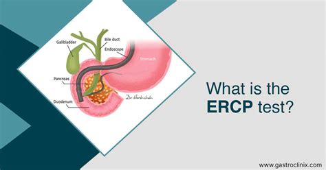 Ercp Dr Harsh J Shah