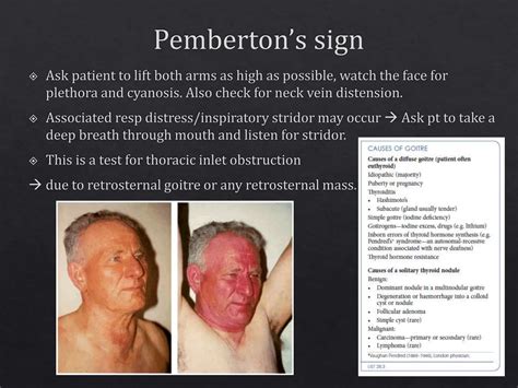 Thyroid Exam Copypptx