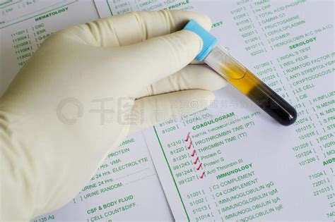 病人高清图片 手套握试管血液检测报告 手套握试管血液检测报告图片免费下载 5140086170 千图网pro