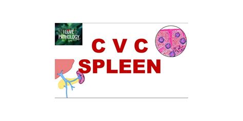 Chronic Venous Congestion Spleen Pathology Made Simple