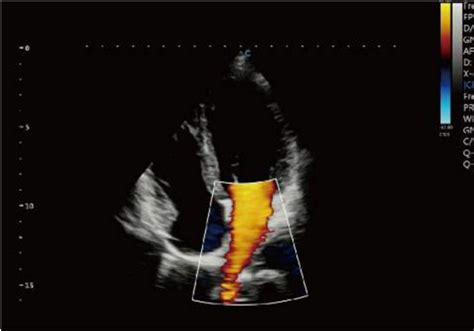 Ecógrafo Chison Xbit 90 Global Ultrasonido
