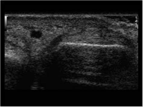 Musculoskeletal Joints And Tendons 6 4 Fingers Case 6 4 1
