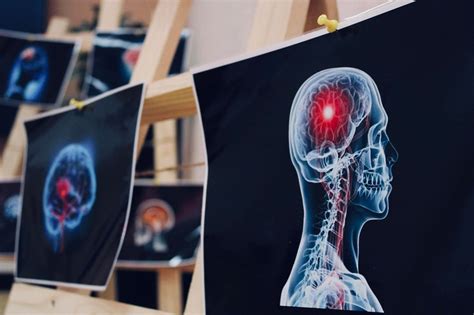 აკაკი წერეთლის სახელმწიფო უნივერსიტეტის მედიცინის ფაკულტეტი დასავლეთ საქართველოს სამედიცინო