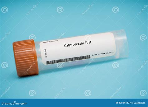 Calprotectin Test Stock Image Image Of Measures Levels 278114177