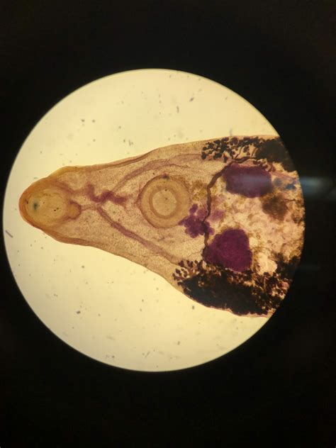 Digenea Diagram Quizlet
