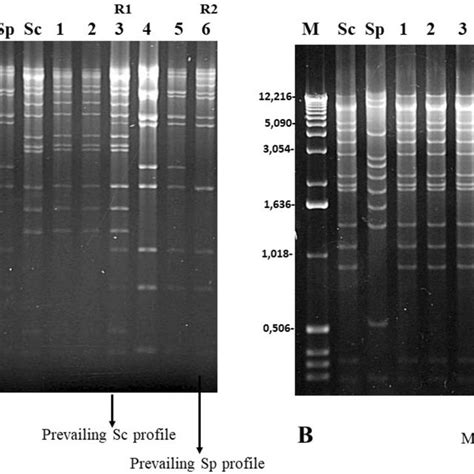 Ecorv Restriction Analysis Of Mitochondrial Dna Mtdna From The