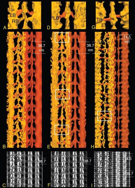 Tomographic Image Reconstructions Of Ifm In Three Equilibrium States