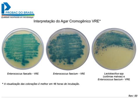 Agar Vre Interpretacion Pdf