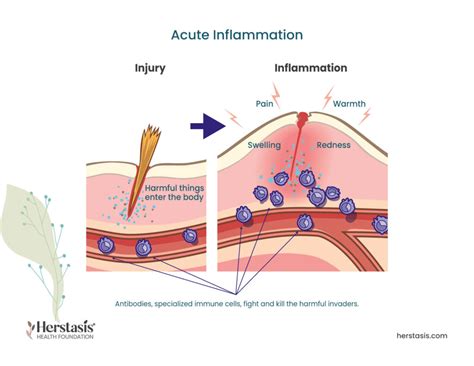Inflammation And Perimenopause Impacts Of Estrogen Herstasis® Health
