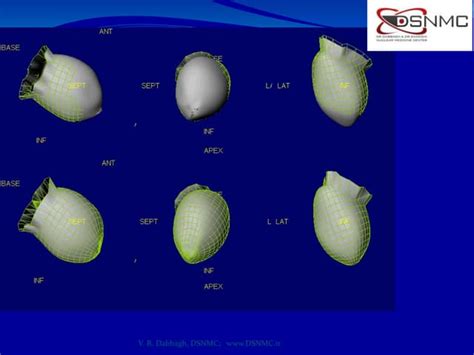 Gated Spect Dsnmc Ppt