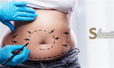Liposuction Complications