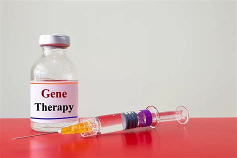 Magic Of Oxr1 Gene Therapy And Diet Effect On Brain Aging