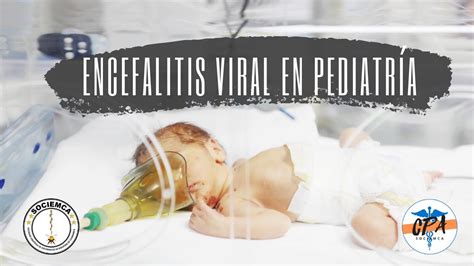 Encefalitis Viral En Pediatría Youtube