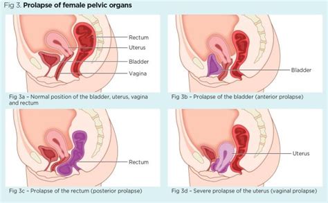 Pelvic Floor Muscles Female Diagram