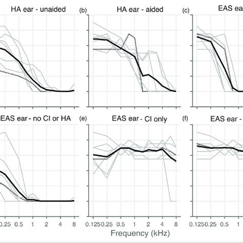 Rationale On How Hearing Asymmetry In Bimodal Eas Users Influences Download Scientific Diagram