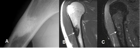 Documento Sin Título