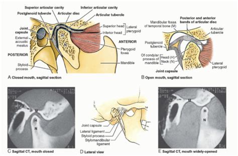 Temporal And Infratemporal Fossae Flashcards Quizlet