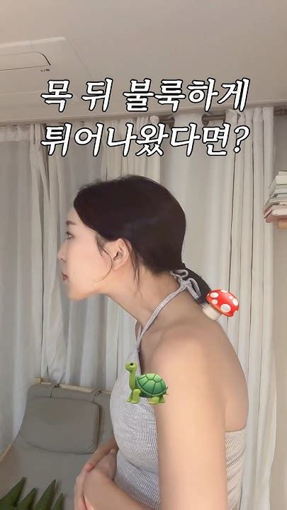 목 뒤 불룩하게 튀어나왔다면 ⚠️ 거북목 버섯목 Youtube