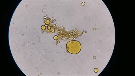 Fecal Fat Test Videos 4k And Hd Video Clips For Download