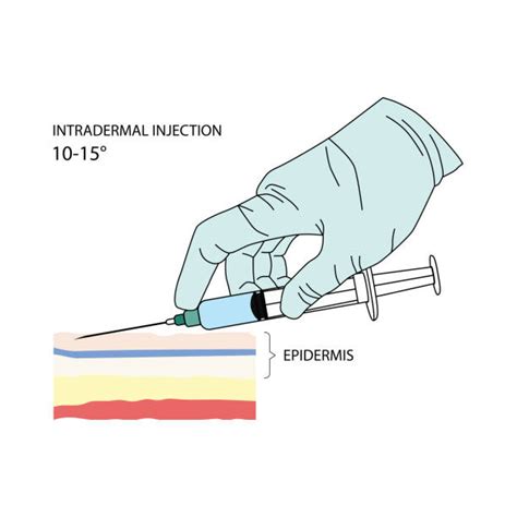 Intradermal Injection Sites