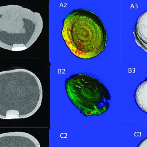 One Way Anova And Lsd Test For The Mct Findings Download Scientific Diagram
