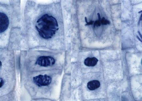 Plant Cell Mitosis Light Micrograph Greeting Card By Steve Gschmeissner