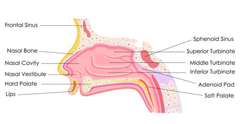 Sinus Passages Bronchiectasis