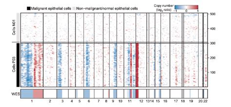 生信分析 个性化分析之恶性肿瘤分析 科研动态 上海伯豪生物技术有限公司 服务科技创新，护航人类健康！