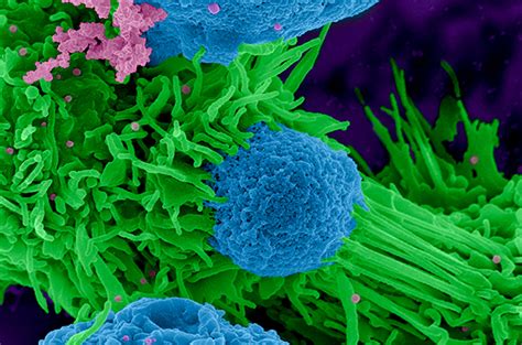 Cryptococcosis Nih Directors Blog Cryptococcosis Nih Directors Blog