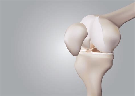 When Is Acl Surgery Necessary Understanding When And Why You May Need It London Hip And Knee