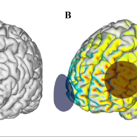 Pdf Transcranial Direct Current Stimulation May Improve Cognitive Motor Function In