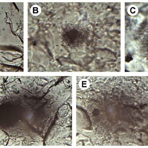 Classification Of G Roeseli Hemocytes In The Comet Assay According To