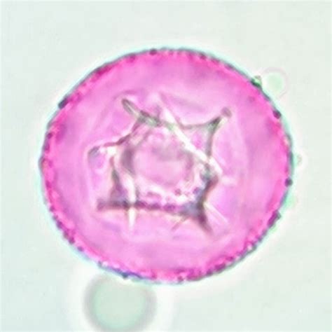 Juniper Pollen Allergy Juniperus A Quick Guide W Photos Allerma™