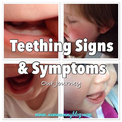 Rosy Cheeks And Teething At Joyce Hartmann Blog