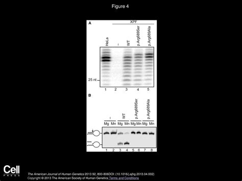 Mutations In Ercc4 Encoding The Dna Repair Endonuclease Xpf Cause