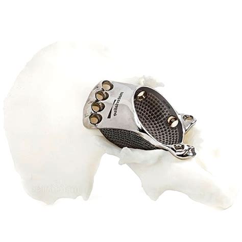 Durable Revision Glenoid Cavity Prosthesis Sale Or Rent Near Me Goldstar Medical Equipment