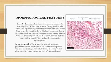 Pathology Of Meningitis Types Etiology Pptx