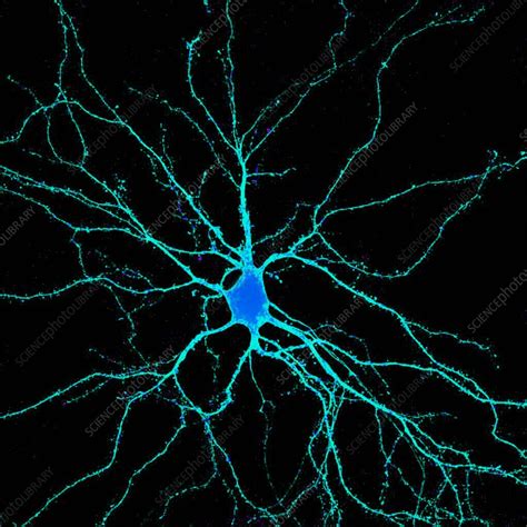 Neuron Fluorescence Micrograph Stock Image C0263197 Science Photo