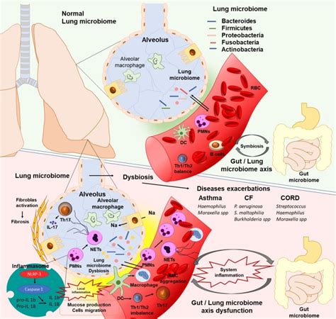 The Lung Microbiome And Pneumonia Where Precision Medicine Meets Pulmonology
