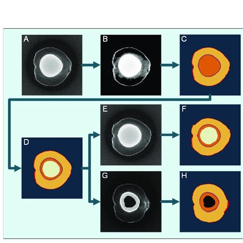 Flow Chart Of Traditional Image Processing Segmentation Algorithm A