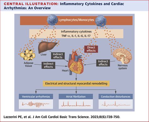 Fir E Ing The Rhythm Inflammatory Cytokines And Cardiac Arrhythmias